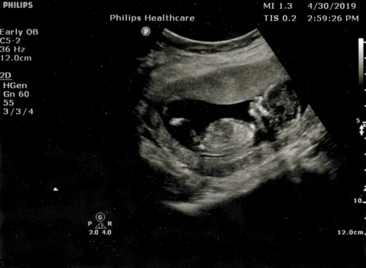 What it’s like to carry your child in your body – Mama Mizell Blog